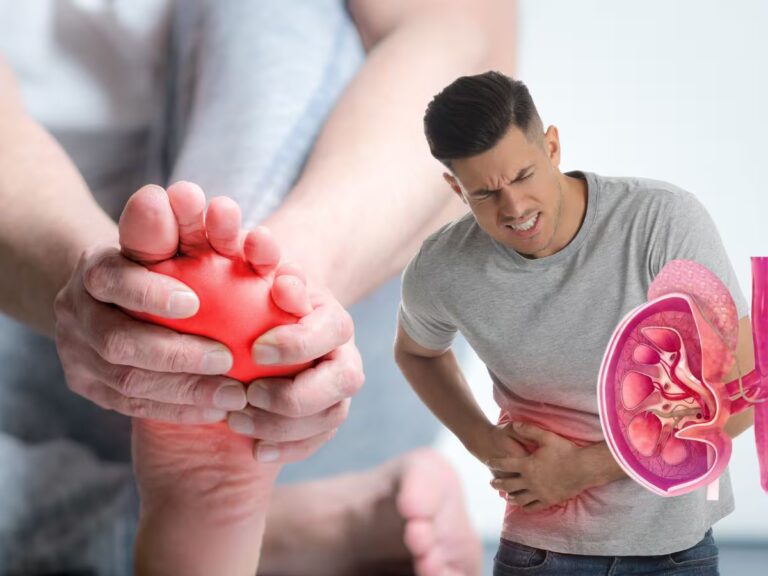 When Passing a Kidney Stone: What to Expect—and When to See a Doctor ...